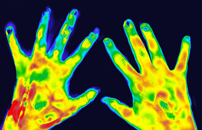 Thermography | Tri-Health Wellness Centre - Natural Healthcare in Vaughan